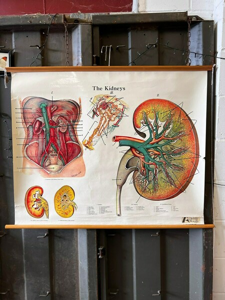 Vintage Kidney Poster Adam Rouilly Large Wall Hung Educational Wall ...