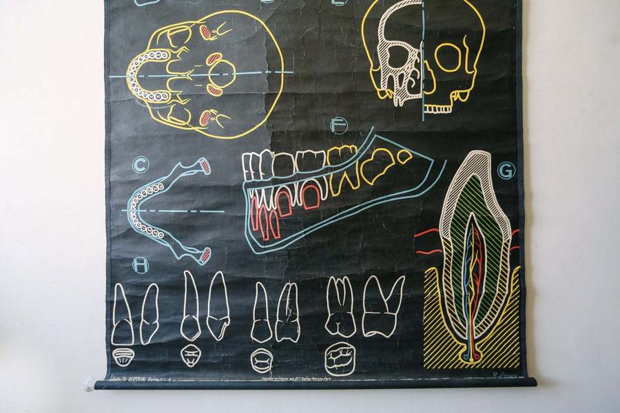 Original Anatomical Vintage Mid Century French School Chalk Wall Chart ...